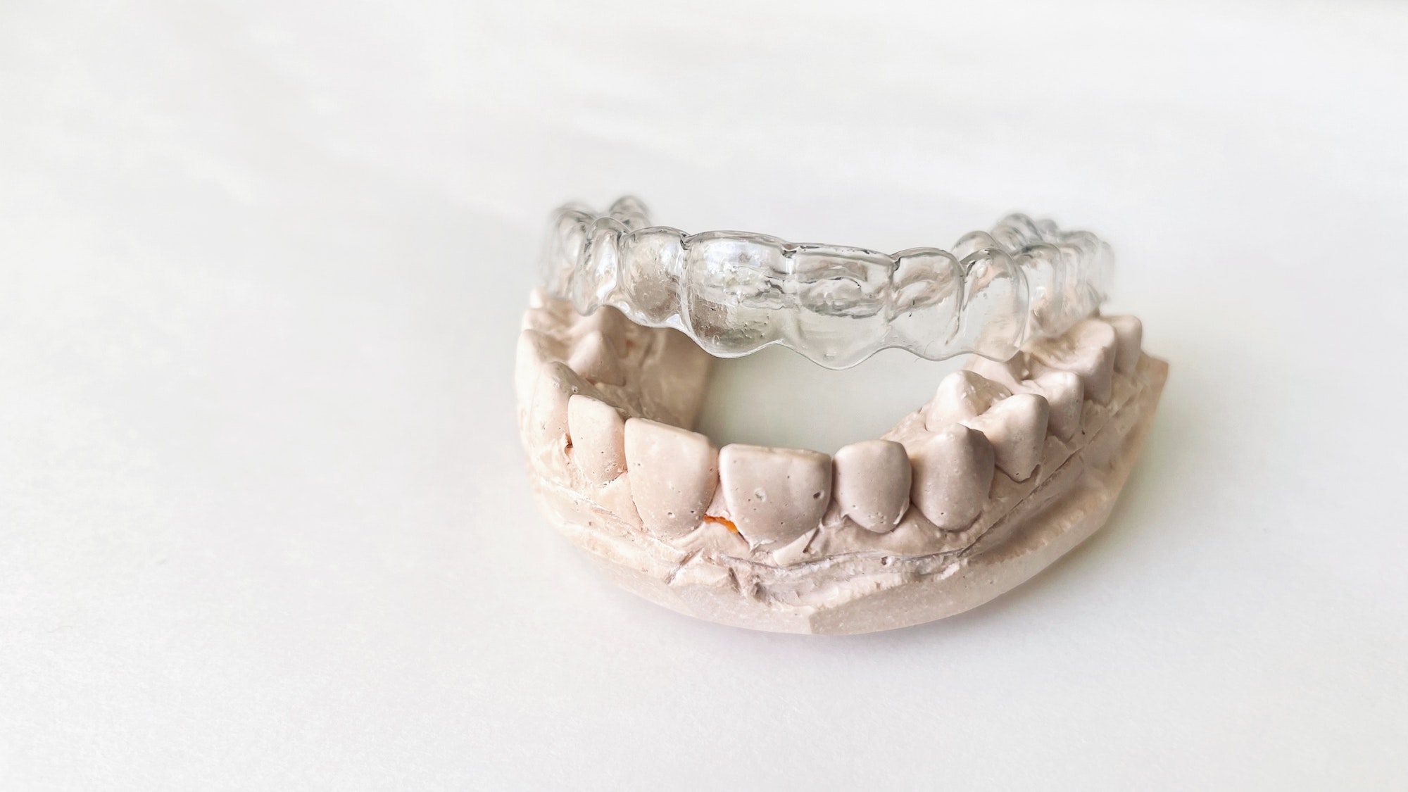Schienentechnik – Sick Dental Labor